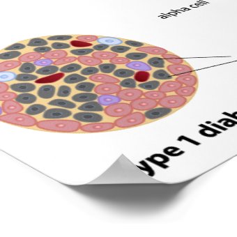 Pancreatic islet and diabetes Poster | Zazzle
