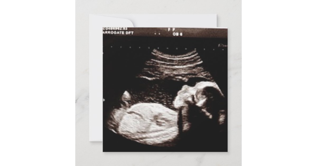 Personalized Ultrasound Picture Baby Shower Invitation | Zazzle