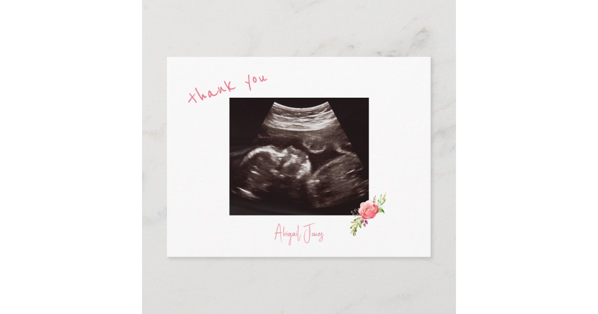 Pink Baby Shower Ultrasound Cute Font Thank You Postcard | Zazzle