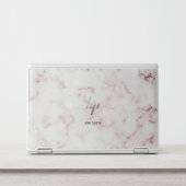 Pink Marble Custom Monogram HP Laptop Skin | Zazzle