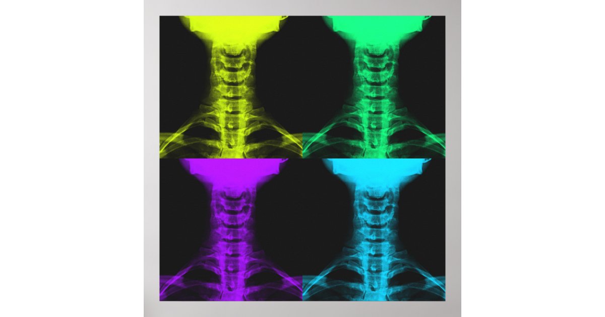 Pop Art Digital X-Ray Poster | Zazzle