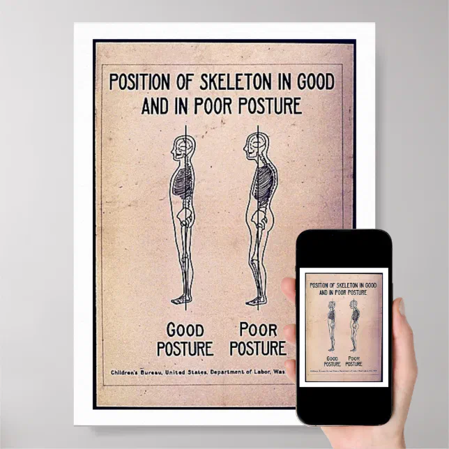 Position Of Skeleton In Good And In Poor Posture Poster | Zazzle