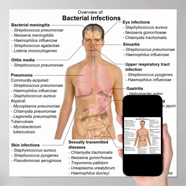 Poster Chart of bacterial infections in Humans | Zazzle
