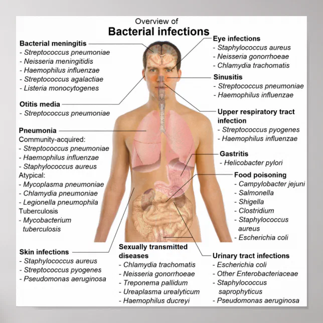 Poster Chart of bacterial infections in Humans | Zazzle