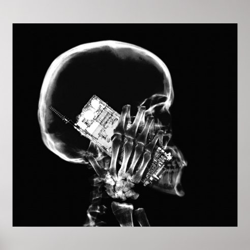 Xray Posters & Prints | Zazzle