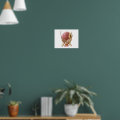Posterior View Of Urinary Bladder Poster | Zazzle