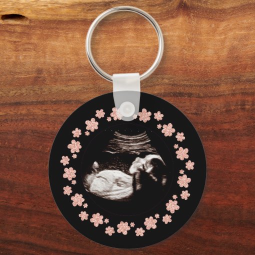 Pregnancy Baby Glitter Sonogram Ultrasound Photo Keychain | Zazzle