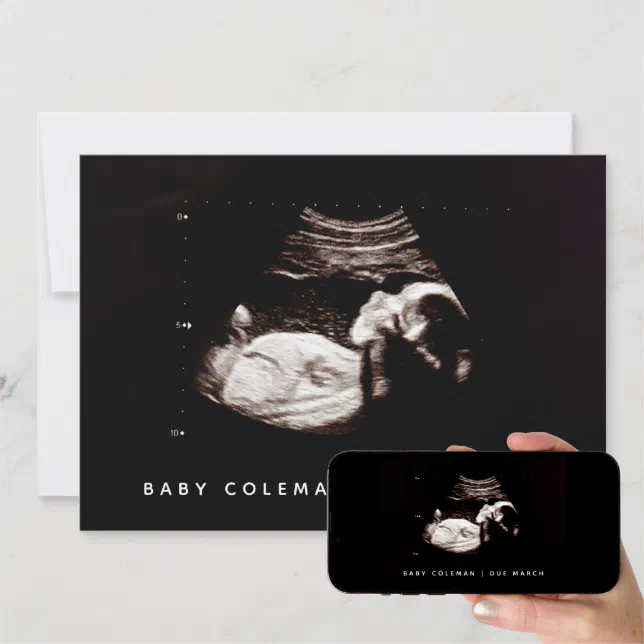 Pregnancy Baby Sonogram Ultrasound Photo Card | Zazzle