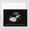 Pregnancy Baby Sonogram Ultrasound Photo Card | Zazzle