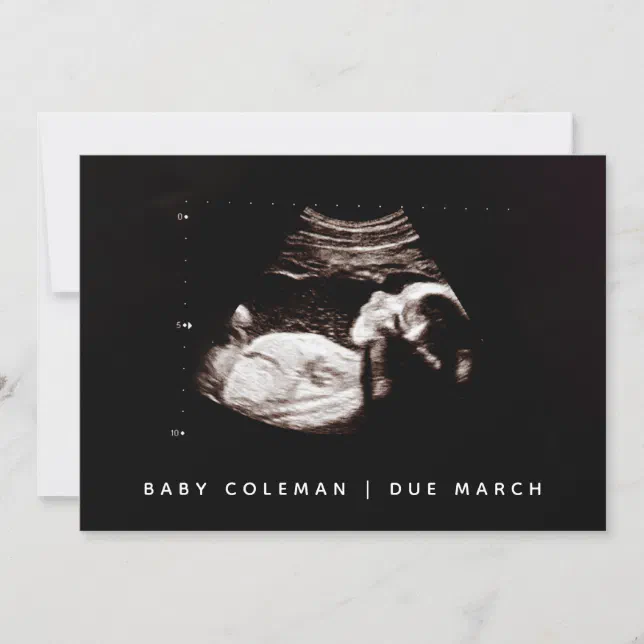 Pregnancy Baby Sonogram Ultrasound Photo Card | Zazzle