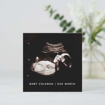 Pregnancy Baby Sonogram Ultrasound Photo Card | Zazzle