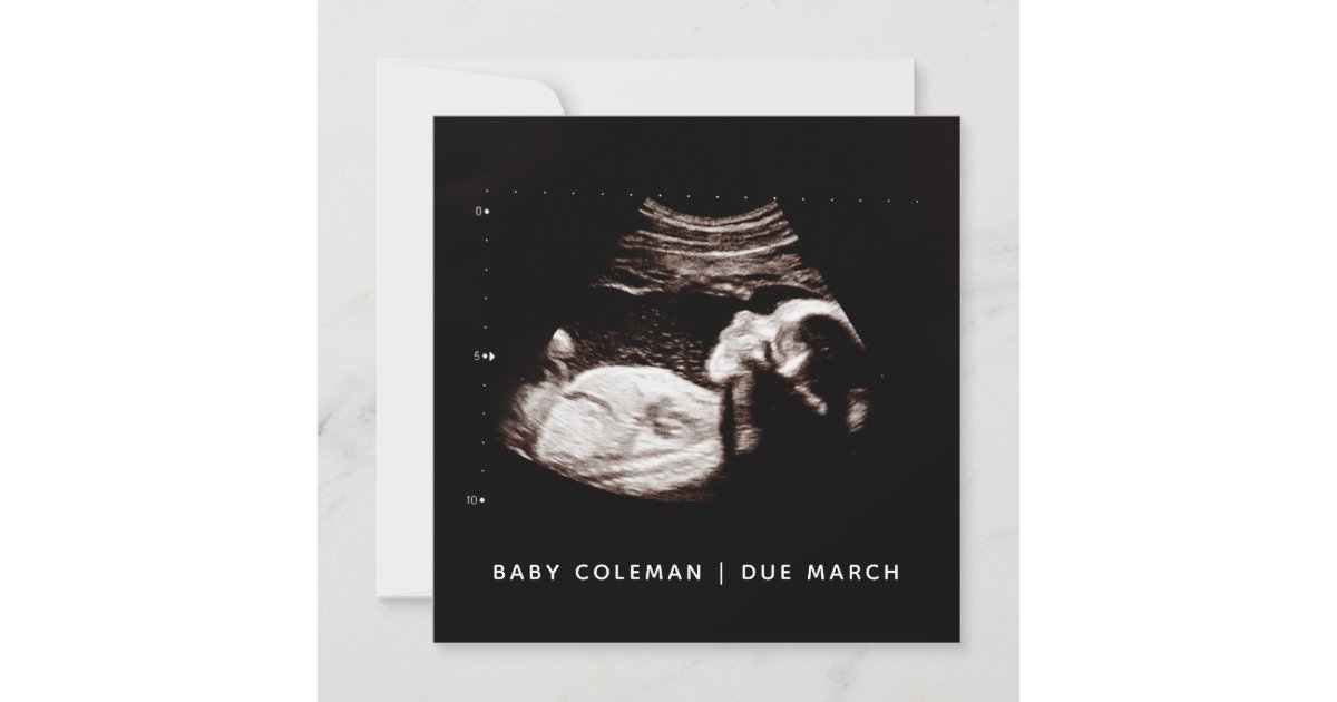 Pregnancy Baby Sonogram Ultrasound Photo Card | Zazzle