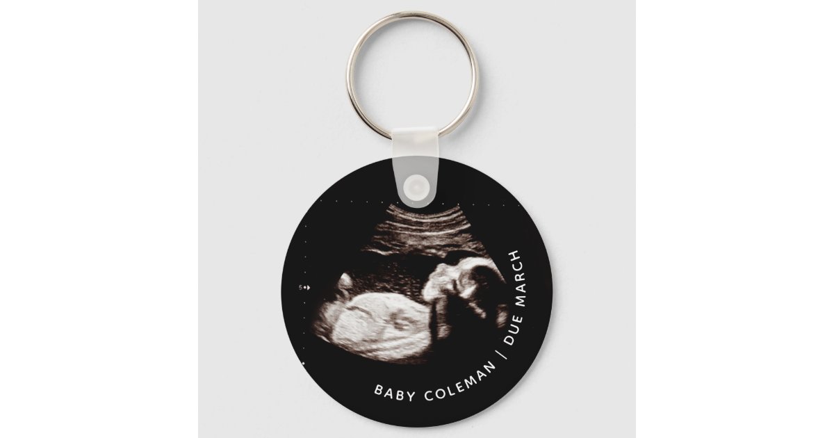 Pregnancy Baby Sonogram Ultrasound Photo New Mom Keychain | Zazzle