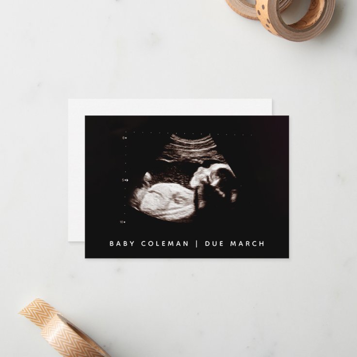Pregnancy Reveal Baby Ultrasound Sonogram Photo Note Card | Zazzle