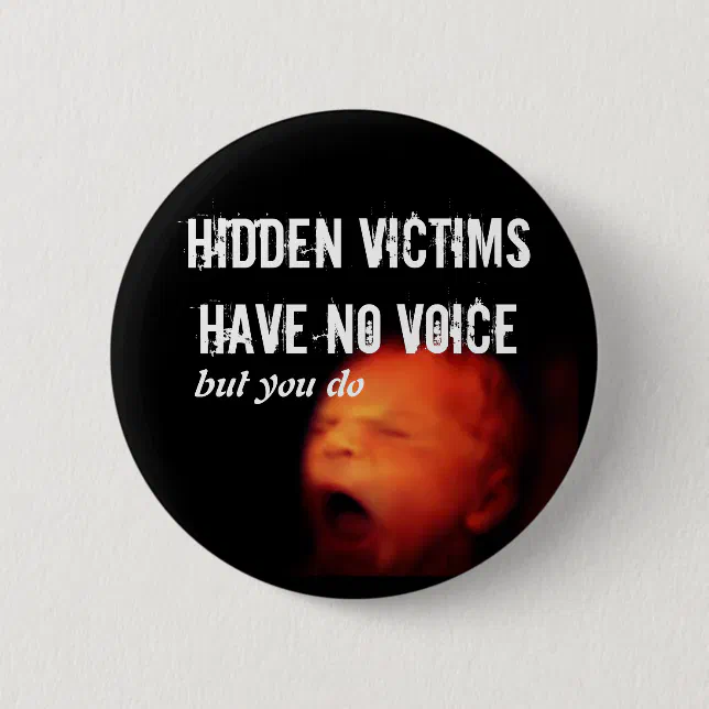 Pro-Life button 1 | Zazzle