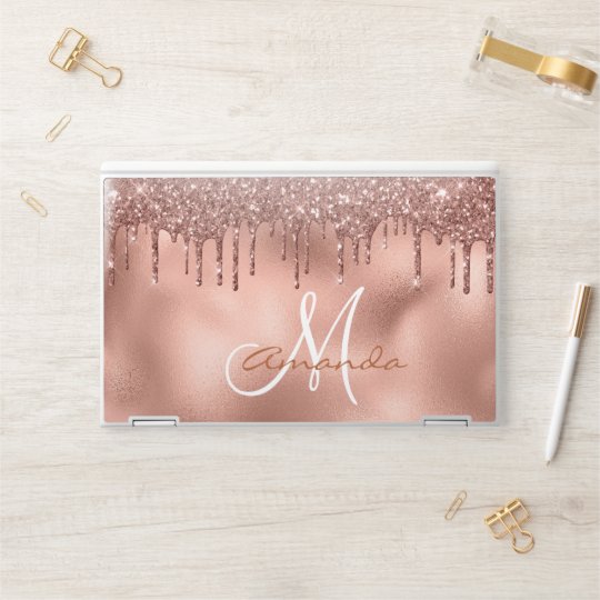 Rose Gold Glitter Drips Personalized Monogram HP Laptop Skin | Zazzle.com