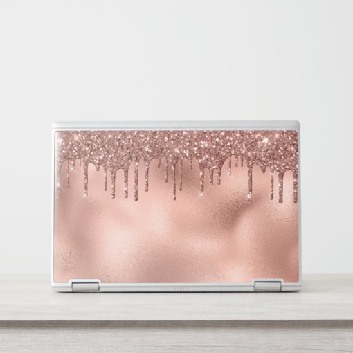 Rose Gold Glitter Look Drips Metallic HP Laptop Skin | Zazzle