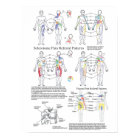Sclerotome Visceral Pain Referral Chart | Zazzle