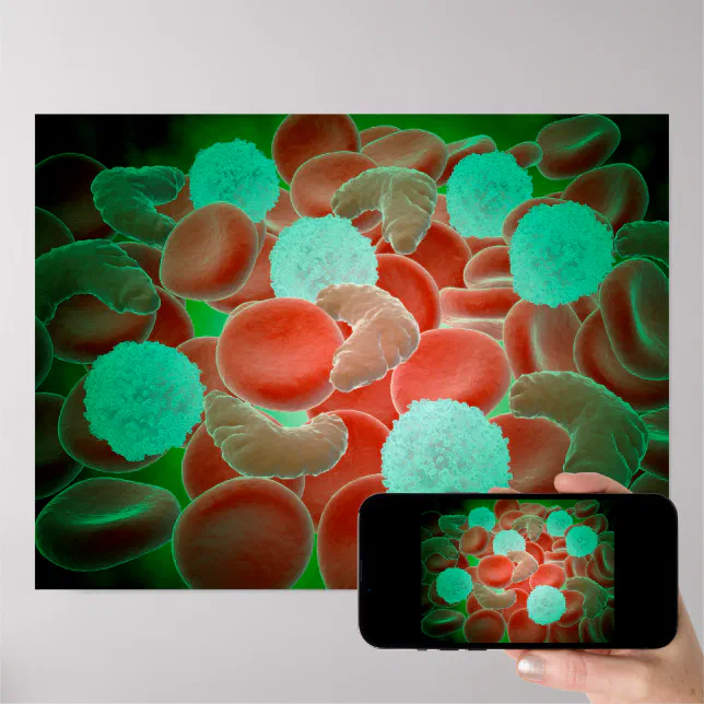 Sickle Cell Anemia With Red Blood Cells Poster | Zazzle