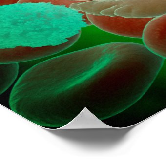 Sickle Cell Anemia With Red Blood Cells Poster | Zazzle