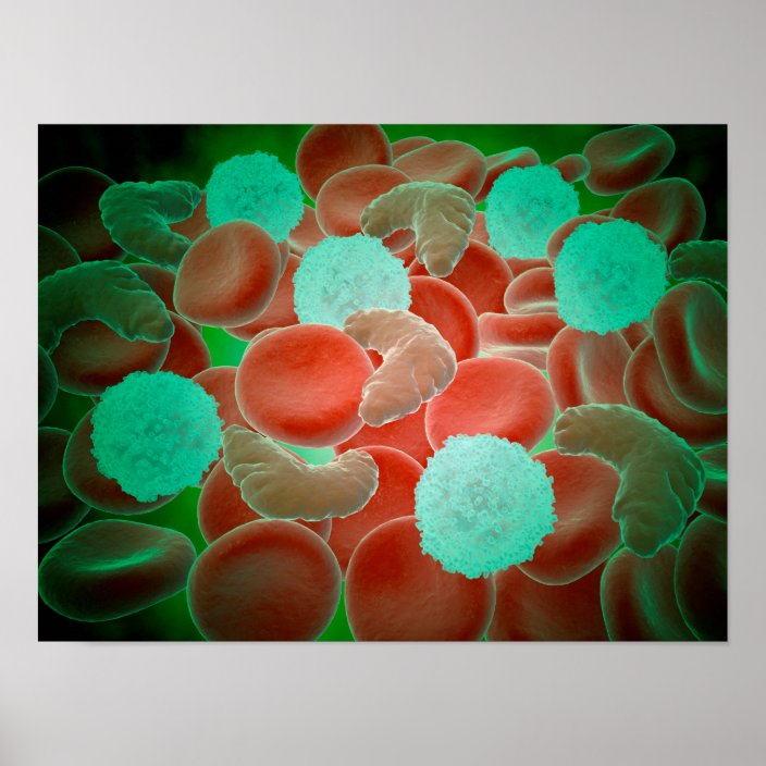 Sickle Cell Anemia With Red Blood Cells Poster | Zazzle.com