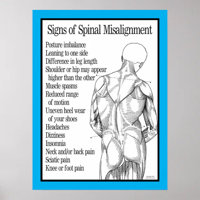 Signs of Spinal Misalignment Chiropractic Poster | Zazzle