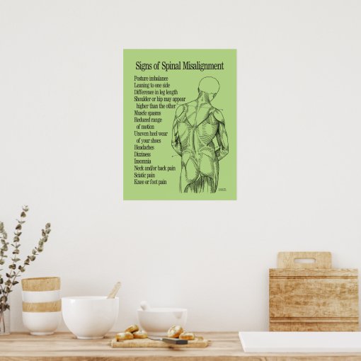 Signs of Spinal Misalignment Chiropractic Poster | Zazzle Signs of Spinal Misalignment Chiropractic Poster | Zazzle