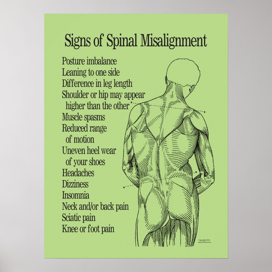 Signs of Spinal Misalignment Chiropractic Poster | Zazzle