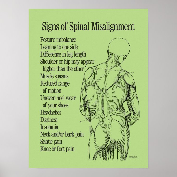 Signs of Spinal Misalignment Chiropractic Poster | Zazzle
