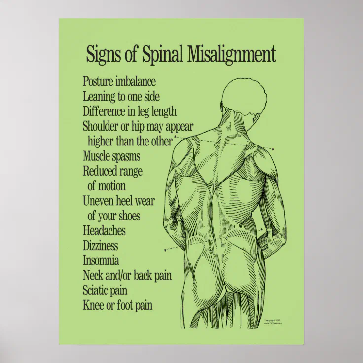 Signs of Spinal Misalignment Chiropractic Poster | Zazzle
