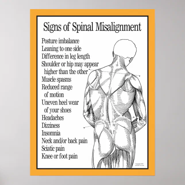 Signs of Spinal Misalignment Poster | Zazzle