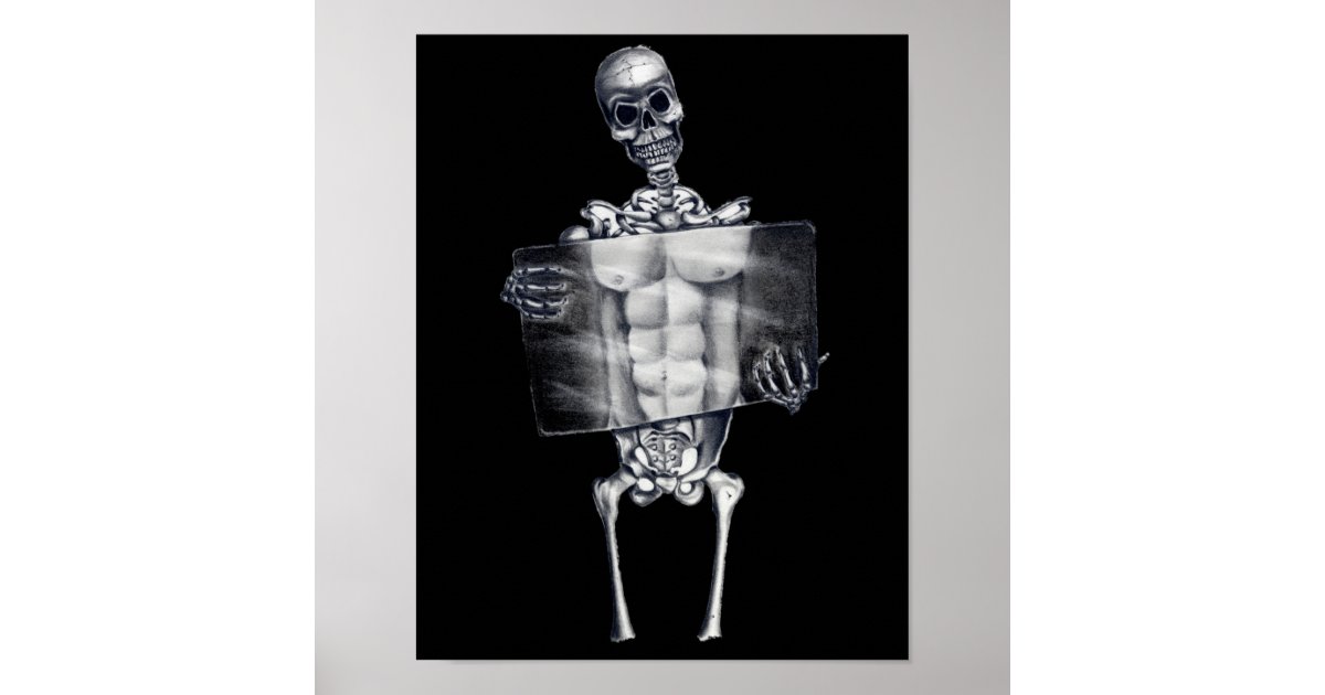 Skeleton Chest Xray Posters | Zazzle
