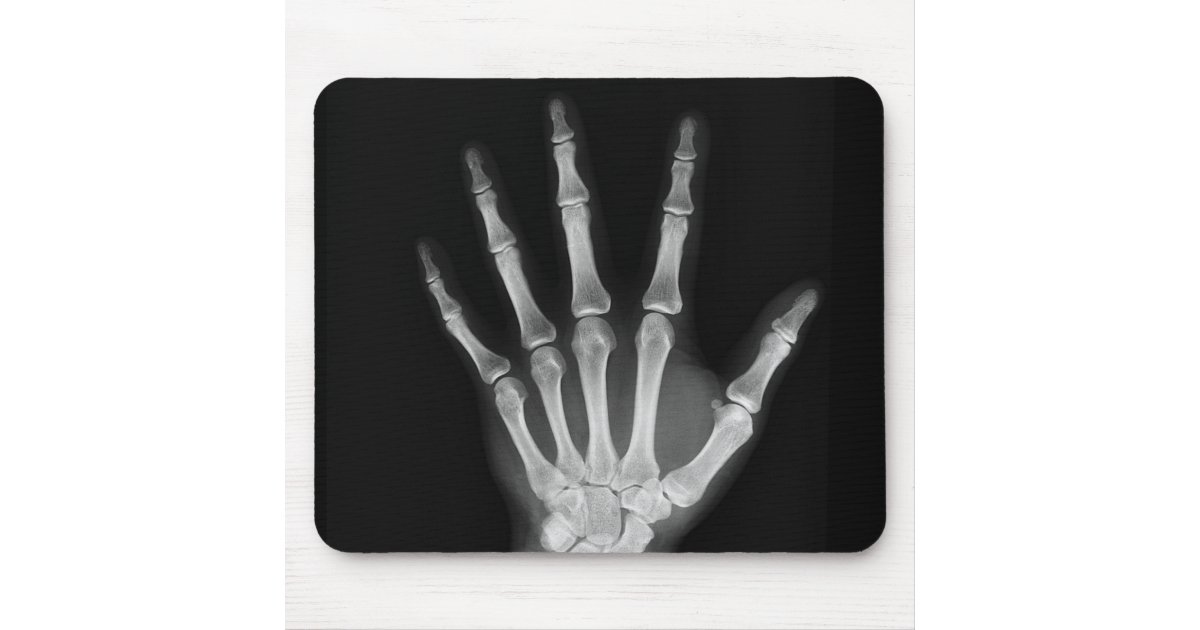 skeleton hand mouse pad | Zazzle