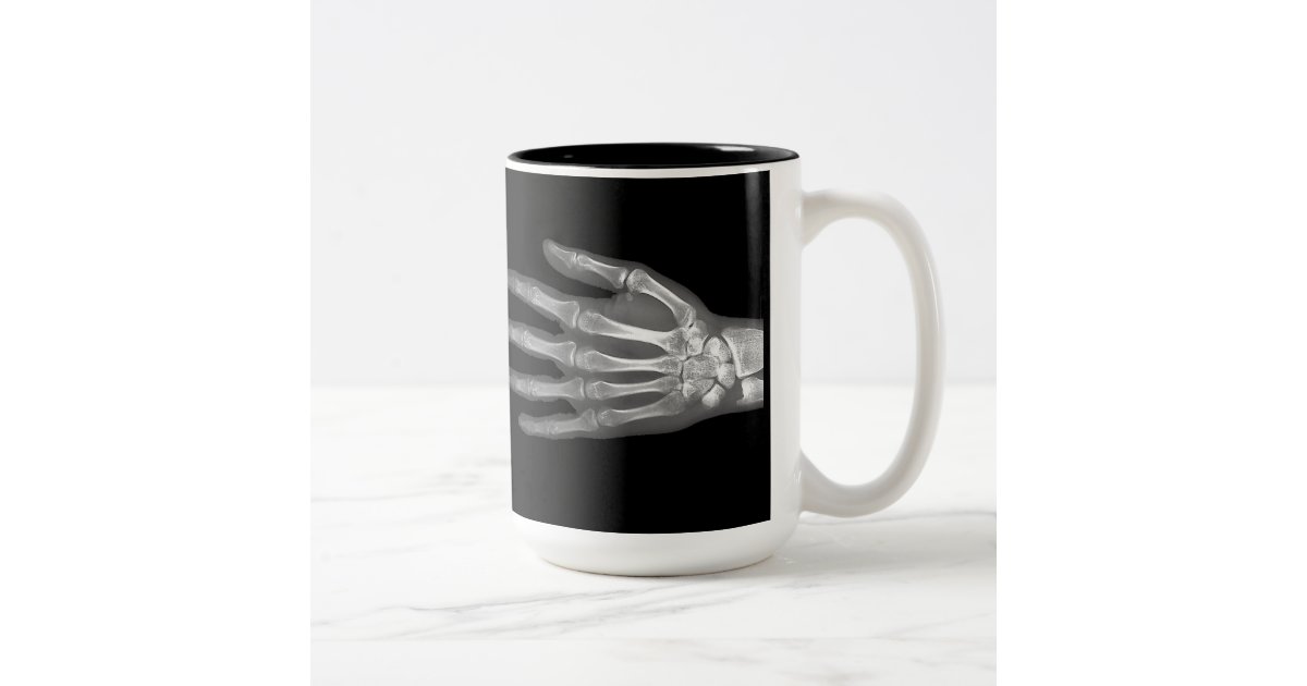 Skeleton Hand X-Ray Mug | Zazzle