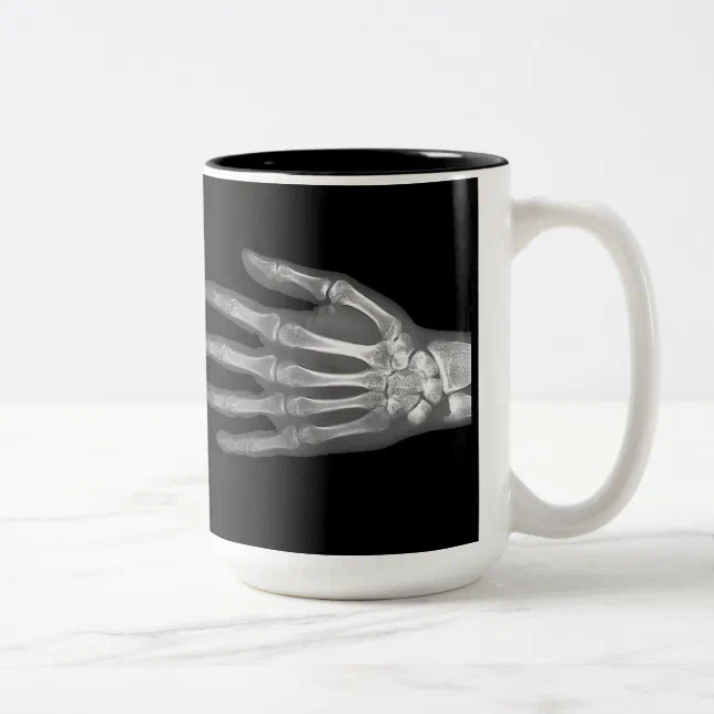 Skeleton Hand X-Ray Mug | Zazzle