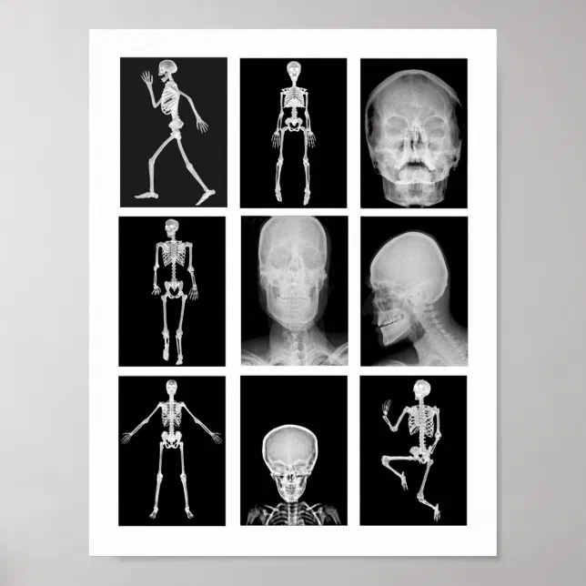 skeleton Skull Human Body XRAYS Collage art Poster | Zazzle