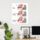 Snoring and sleep apnea Poster | Zazzle