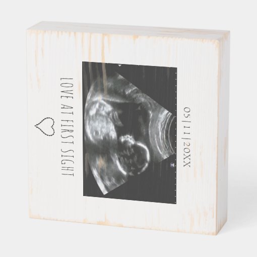 Sonogram Picture Photo Gift Baby Ultrasound Wooden Box Sign | Zazzle