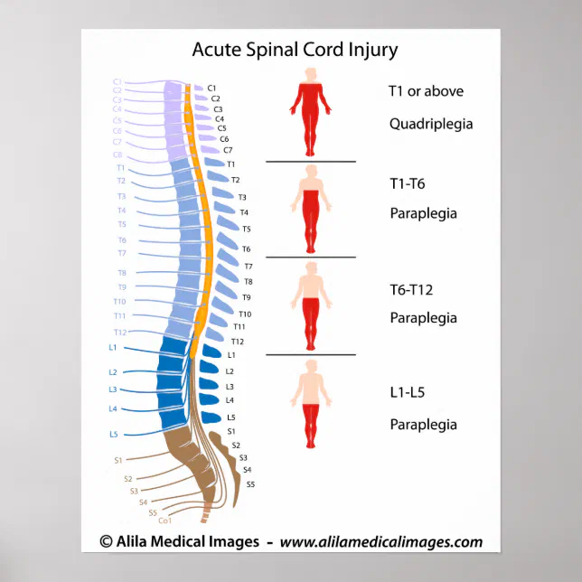 Spinal cord injury levels, labeled diagram. poster | Zazzle