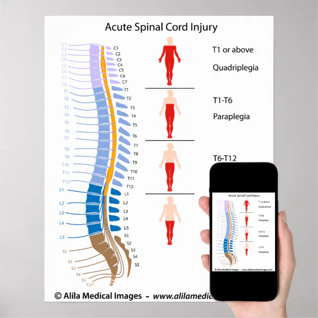 Spinal cord injury levels, labeled diagram. poster | Zazzle