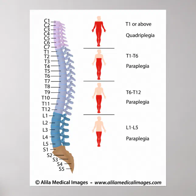 Spinal cord injury levels, labeled drawing. poster | Zazzle