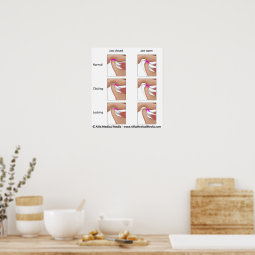 Temporomandibular joint dysfunction, TMJ or TMD Poster | Zazzle