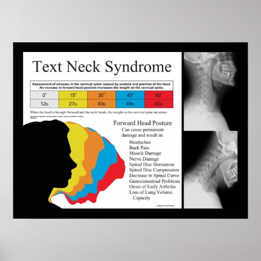 Text Neck Syndrome Chiropractic Poster | Zazzle