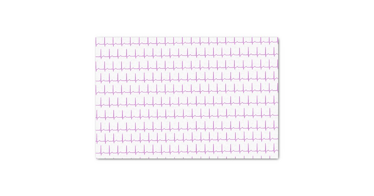Tissue paper - Normal Sinus Rhythm (EKG) | Zazzle
