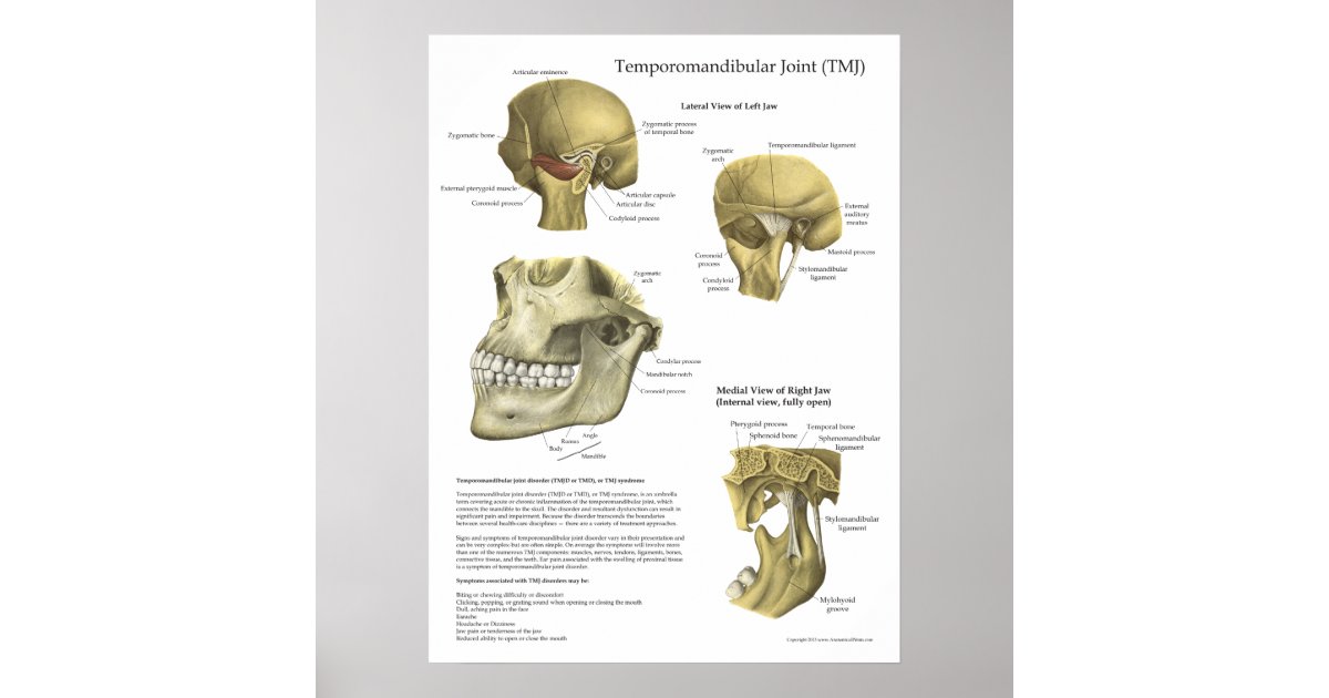 TMJ Joint Syndrome Anatomy Medical Poster | Zazzle