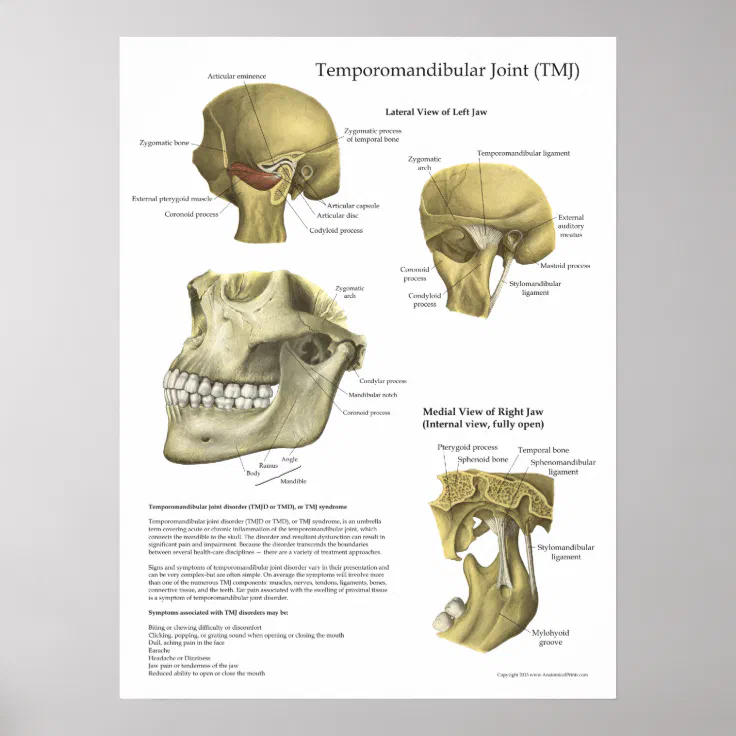 TMJ Joint Syndrome Anatomy Medical Poster | Zazzle