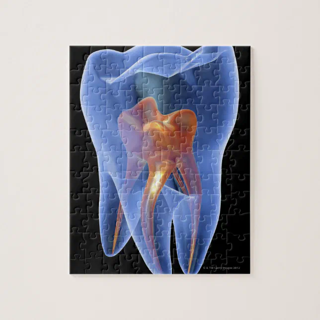 Tooth, transparent cross section of a molar jigsaw puzzle | Zazzle