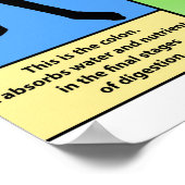 Ulcerative Colitis Poster | Zazzle