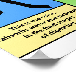 Ulcerative Colitis Poster | Zazzle