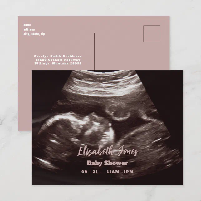 Ultrasound Photo Pink Baby Shower Announcement Postcard | Zazzle